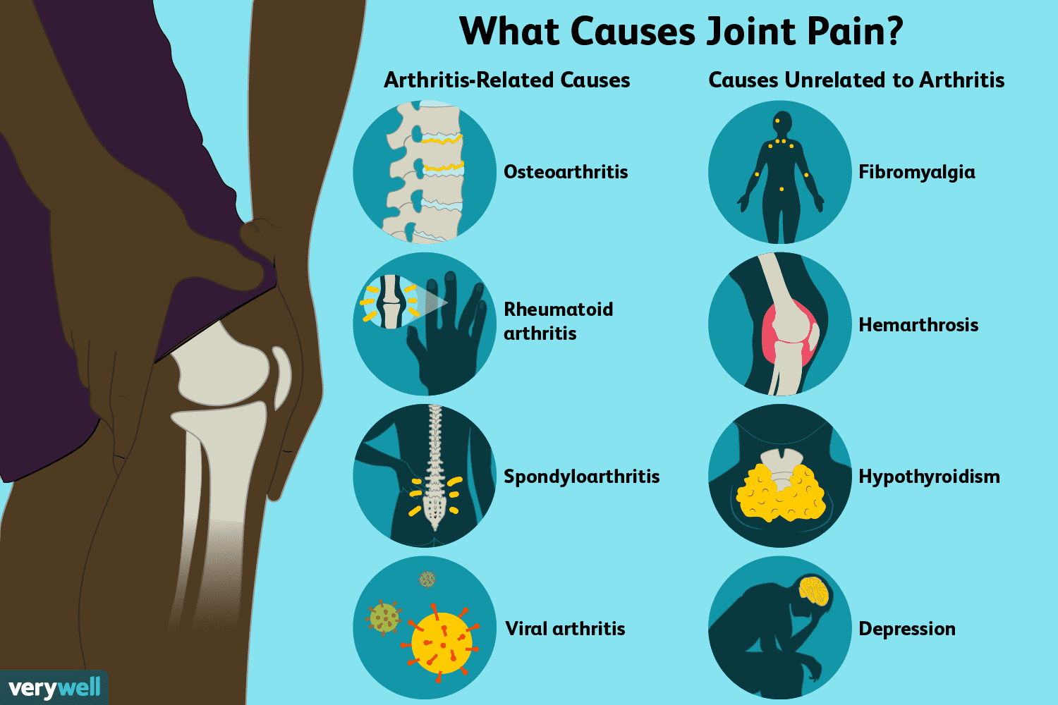 What protein can cause joint pain?