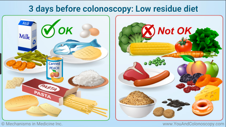What should I eat a few days before colonoscopy?