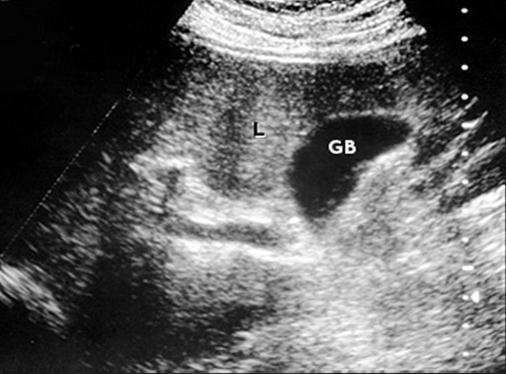 What stomach problems can be seen on ultrasound?