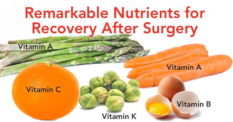 What to eat after surgery to heal faster?