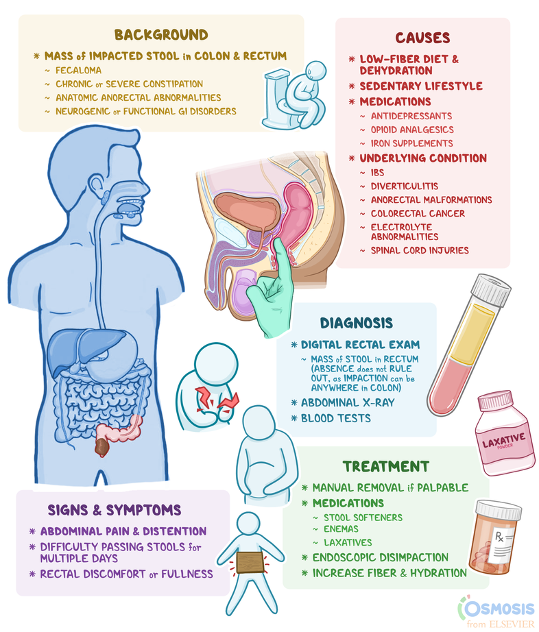 When does constipation become faecal impaction?