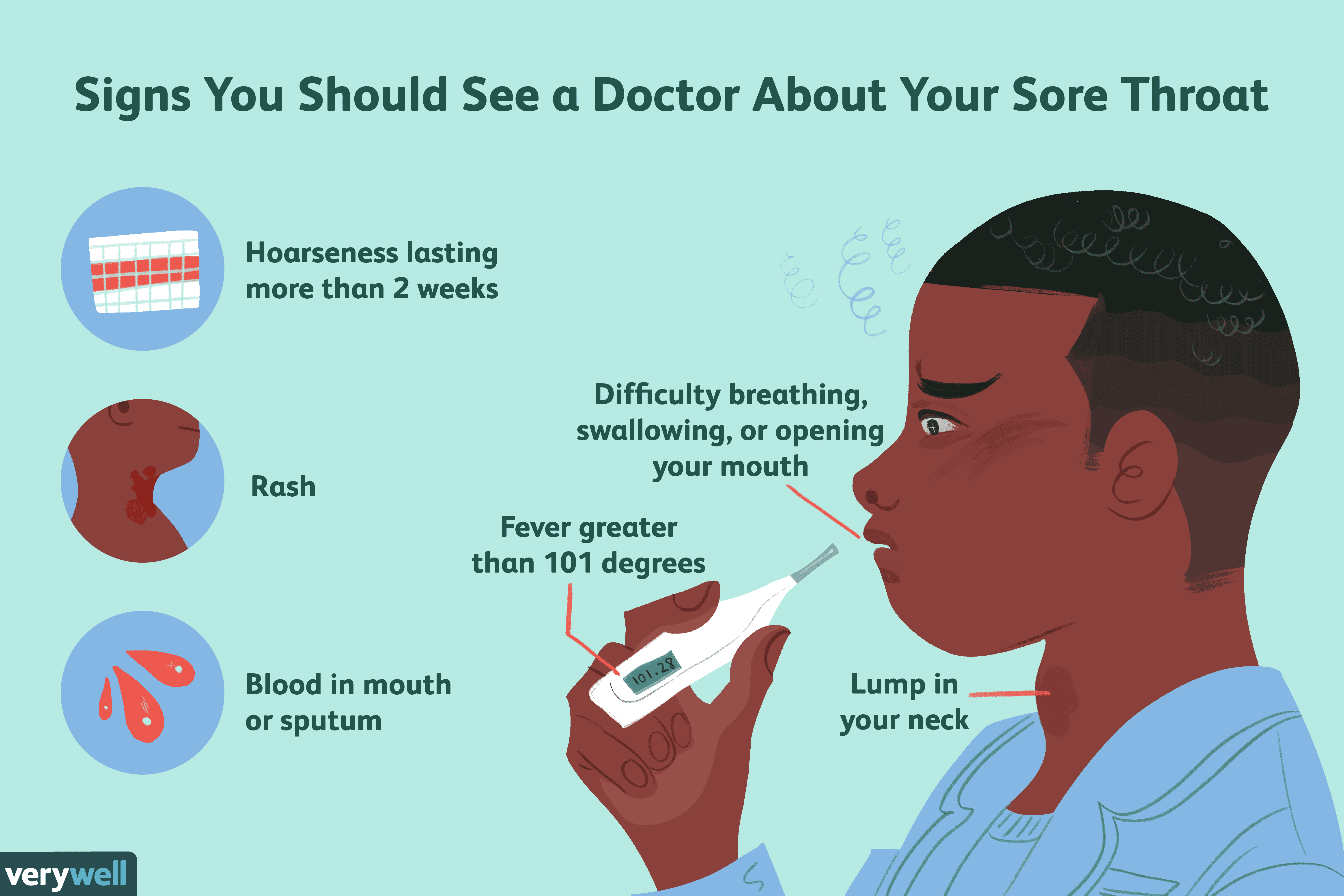 When should I be concerned about a sore throat?