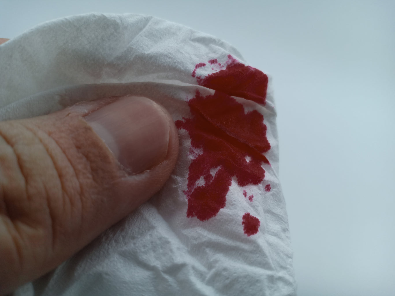 When should I be worried about blood when I wipe?