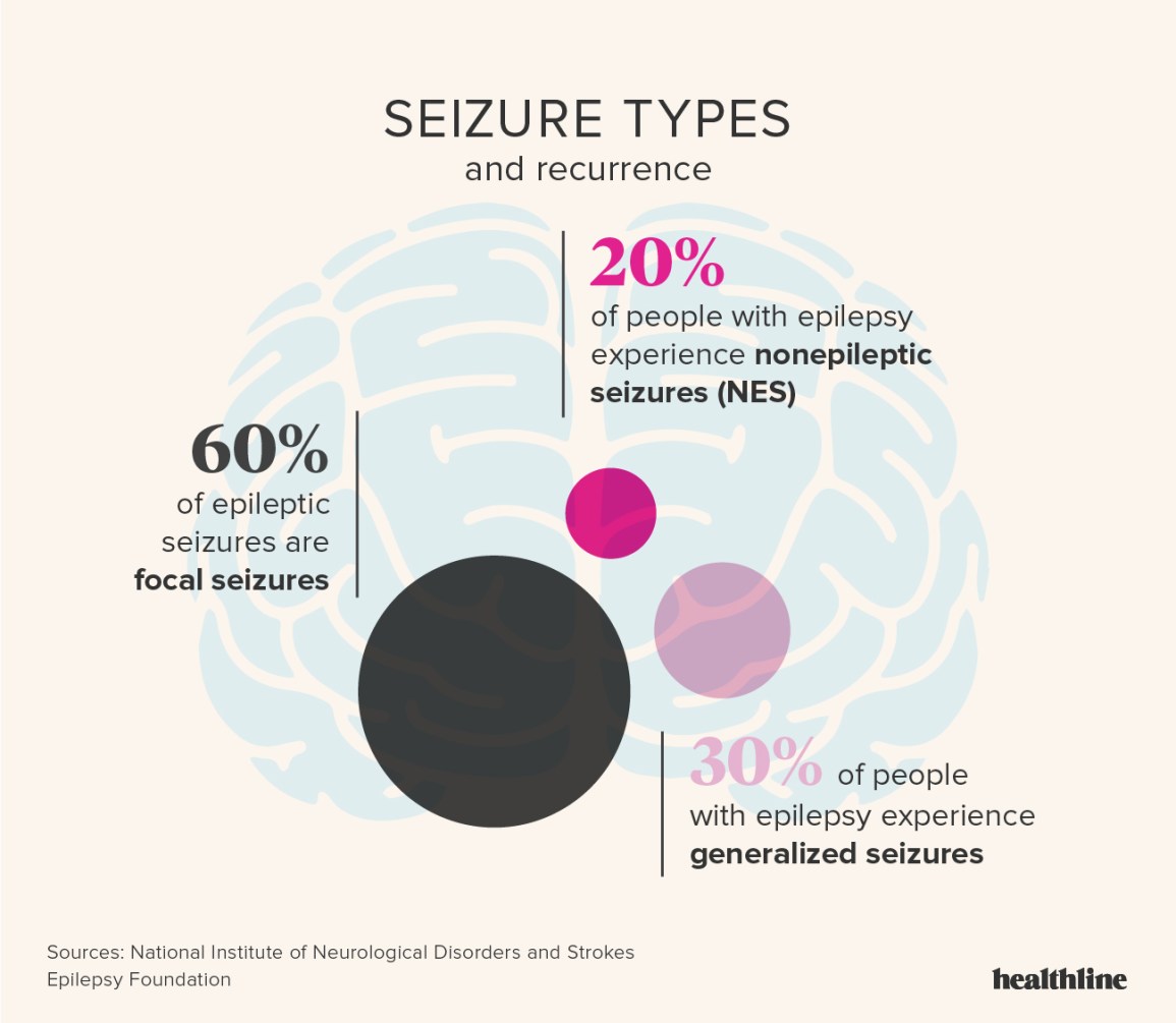 Where is epilepsy most common?