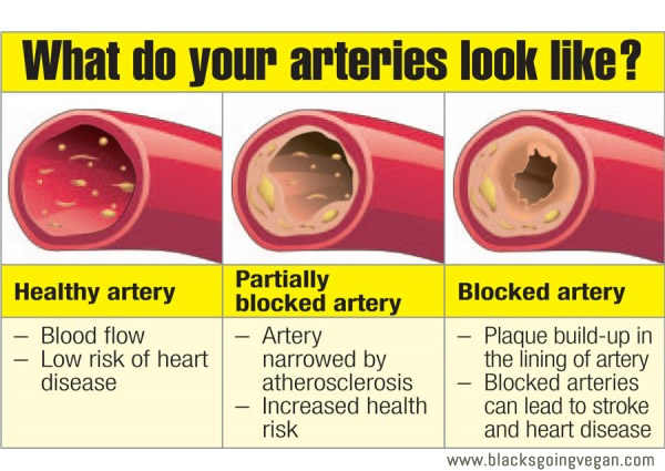 Which fats clog your arteries?