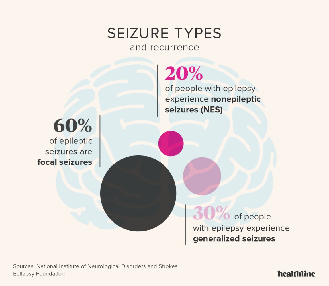 Who is most commonly diagnosed with epilepsy?