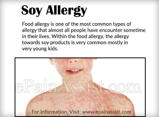 Why am I suddenly allergic to soya?