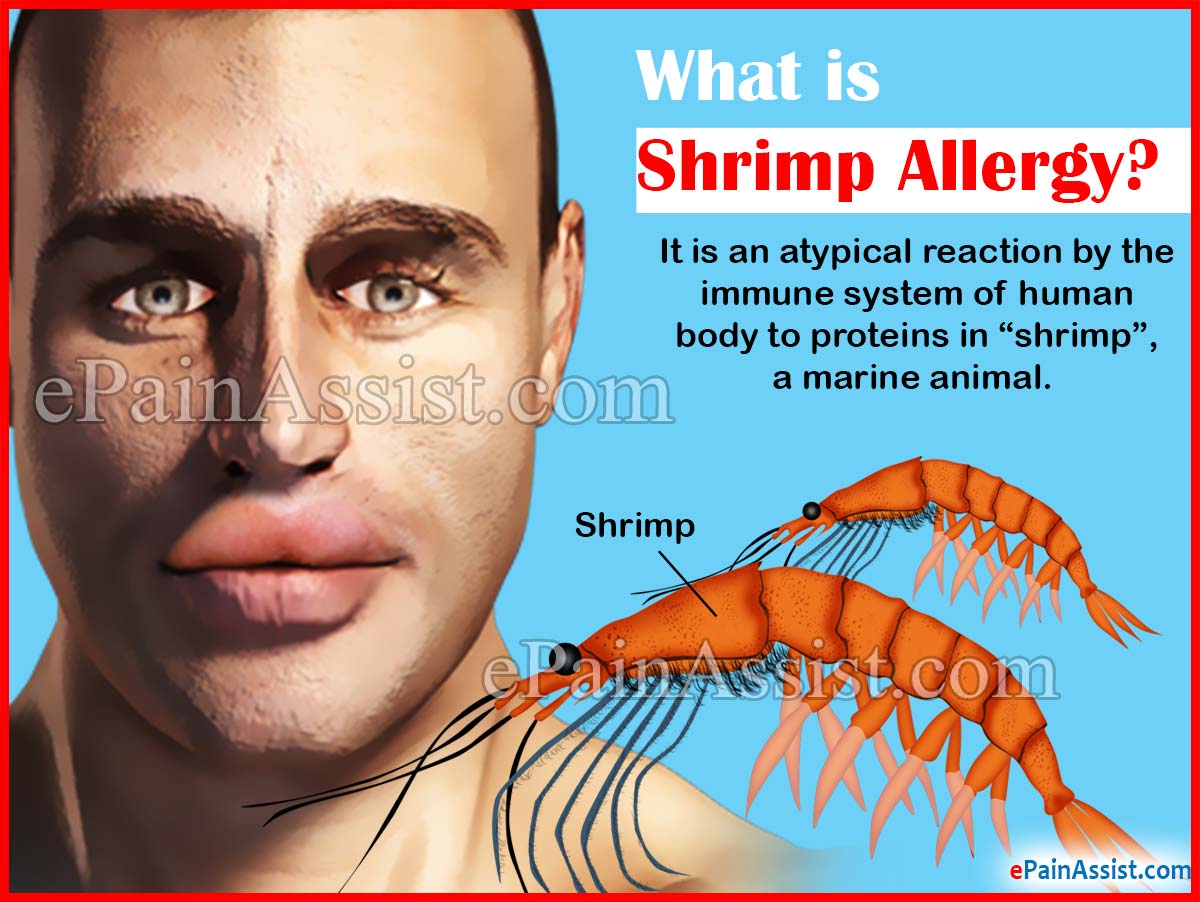 Why are prawns allergic?