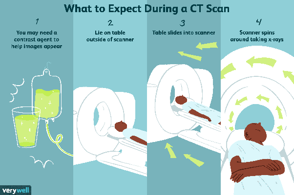 Why can't you have caffeine before a CT scan?