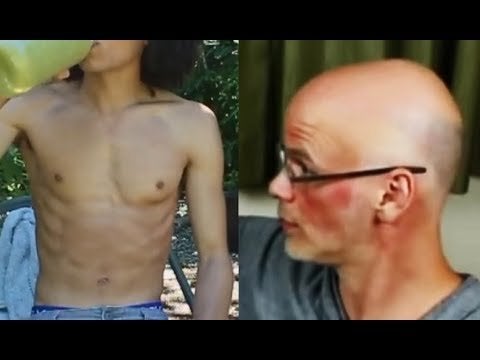 Why do some vegans look malnourished?