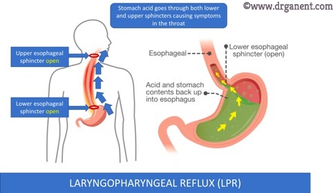 Why does my throat hurt after eating spicy?