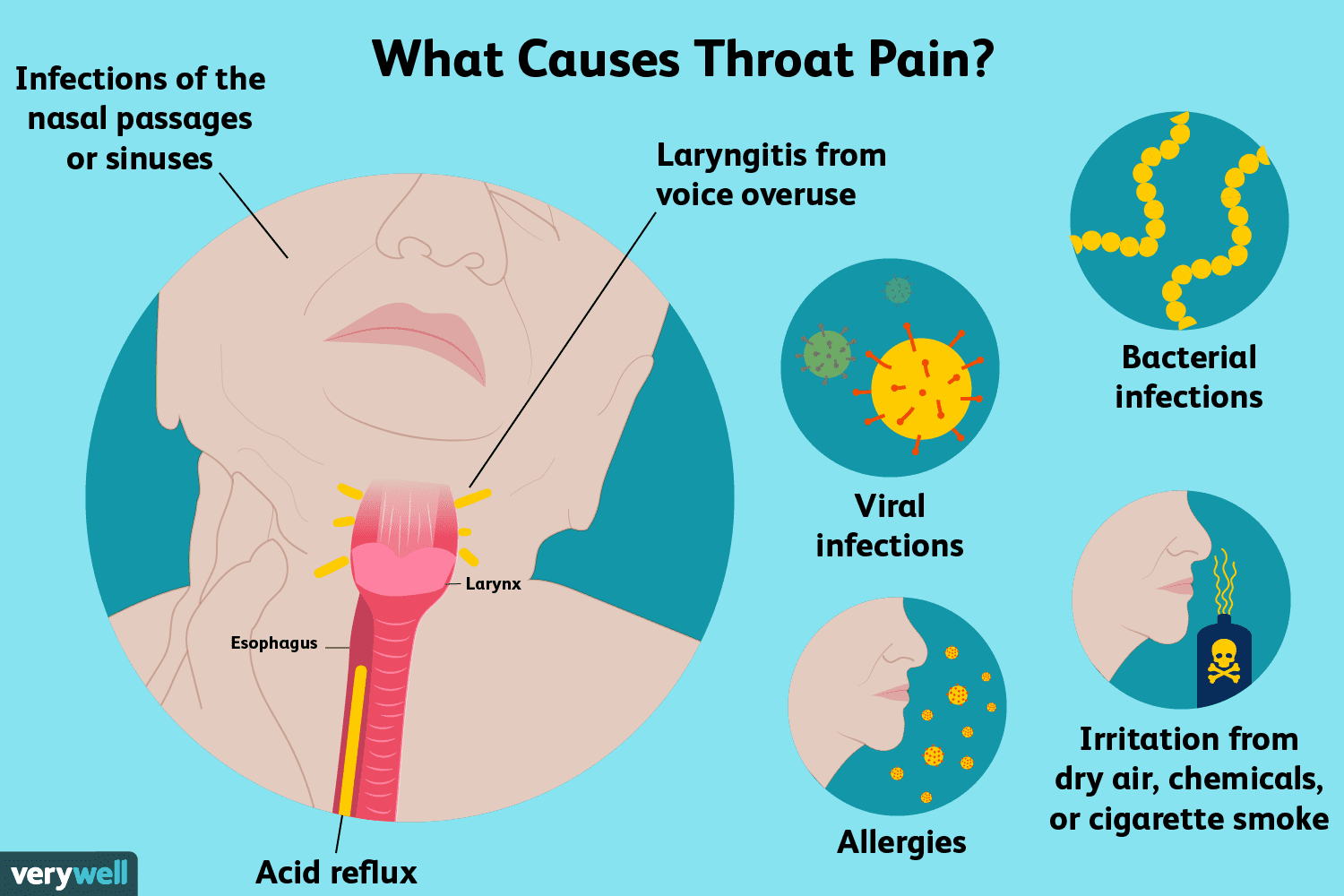 Why does my throat hurts after eating?
