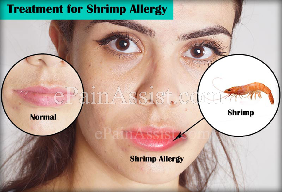Why is everyone allergic to shrimp?