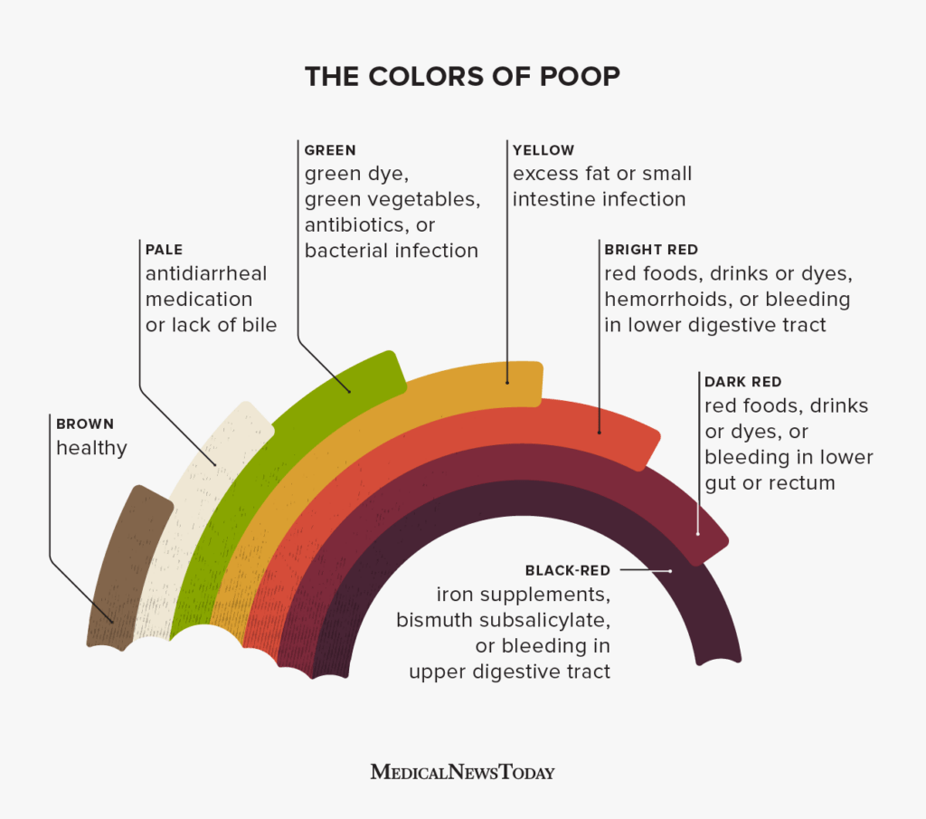 Why is my poop like a yellow color?