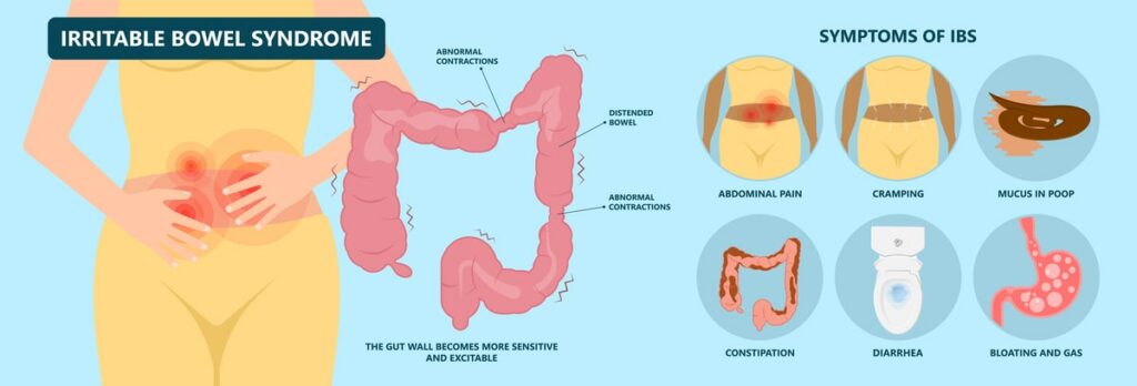 Why is my stomach so noisy IBS?